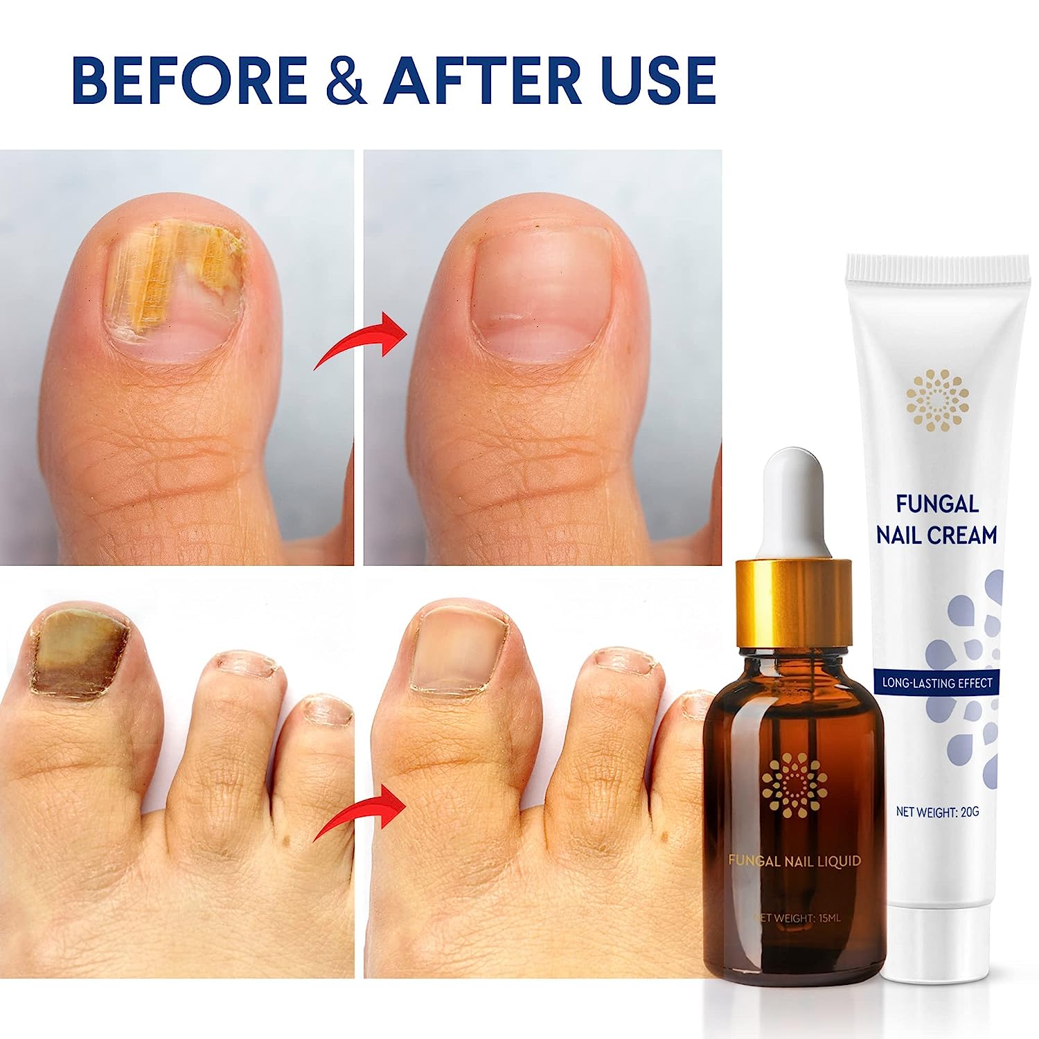 Treatment for Fingernails, Liquid(15ML) and Nail Repair Cream(20G) Kit